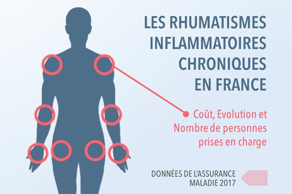 Ensemble contre les rhumatismes